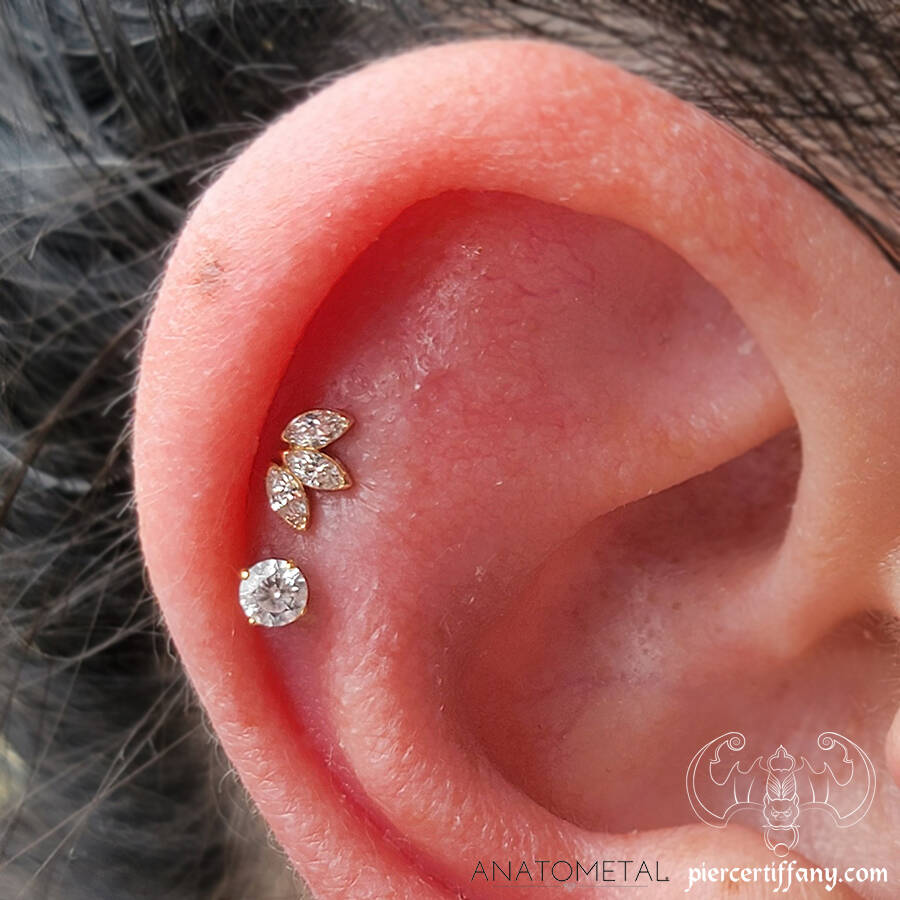 Helix, Cartilage, or Midway
